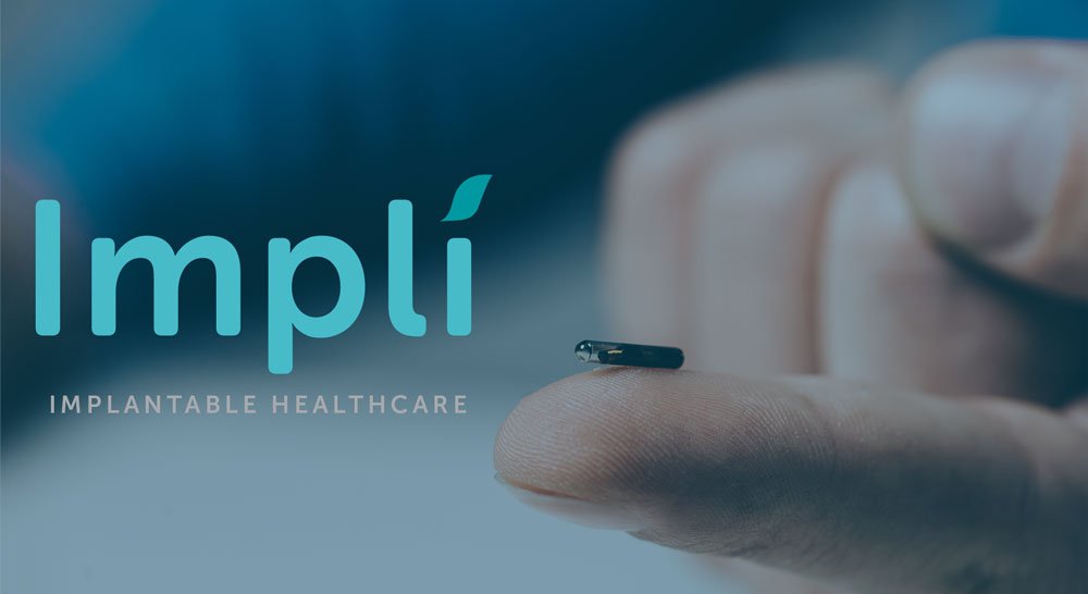 How Impli are expanding their health-tech implants to the US - via ...